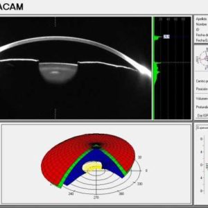 OCULUS Pentacam HR