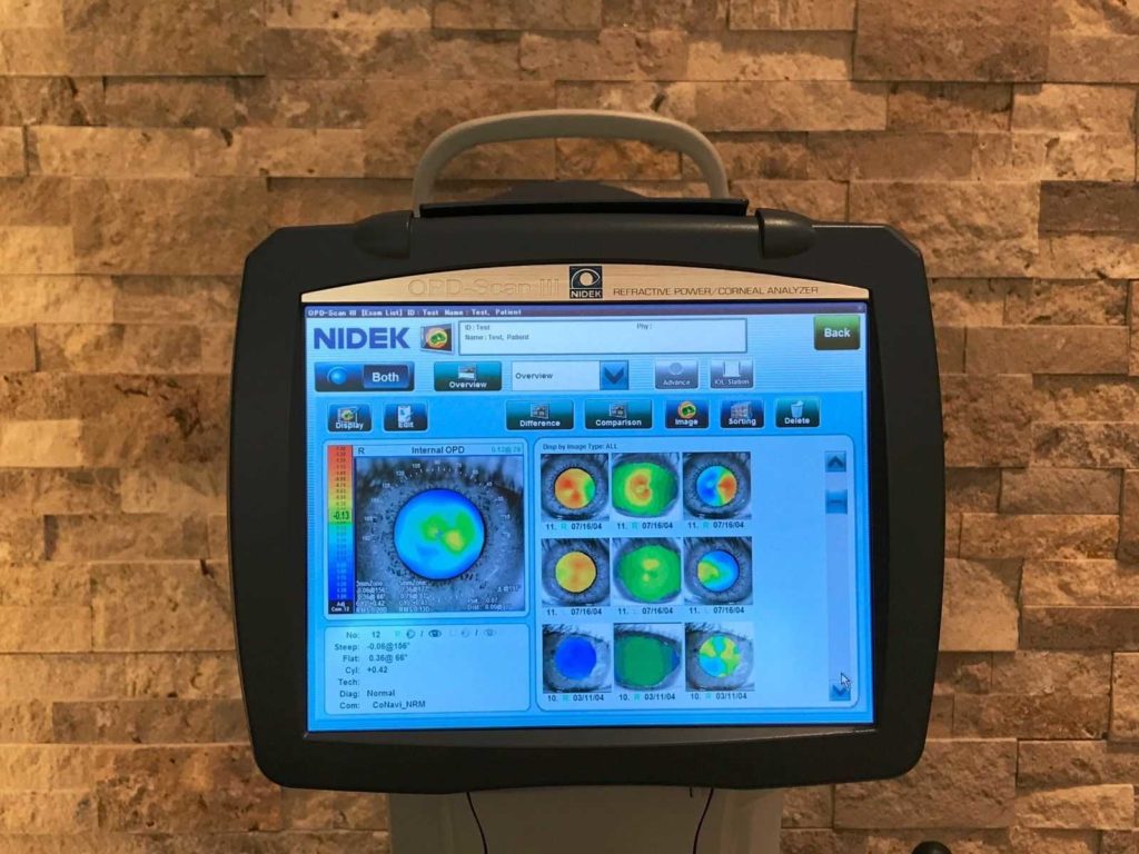 Nidek Marco OPD Scan III Corneal Topographer - ophthalmicmart
