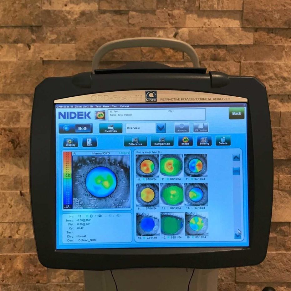 Marco OPD Scan III Corneal Topographer