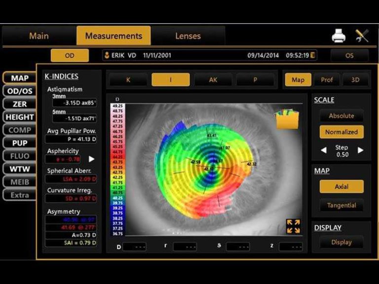 Topcon CA-800 Corneal Analyzer - Ophthalmicmart