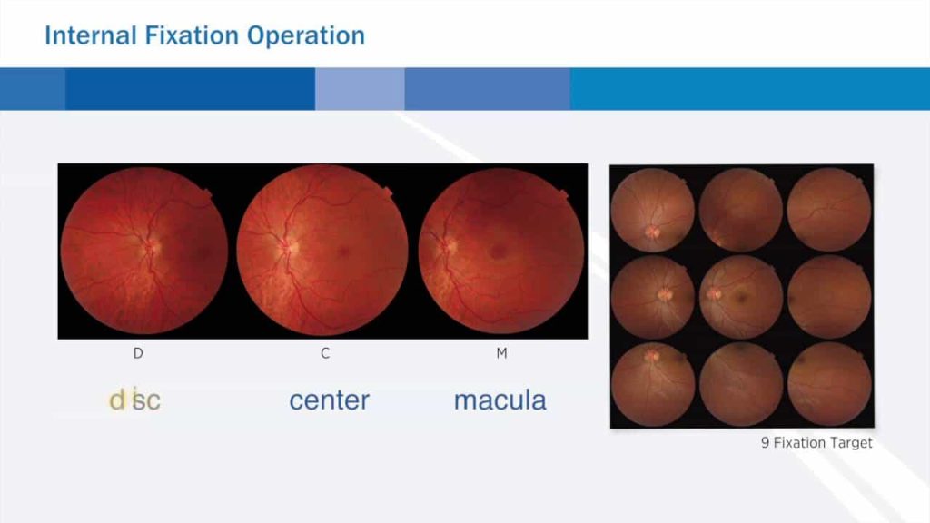 Topcon TRC-NW400 Non-Mydriatic Retinal Camera - Ophthalmicmart