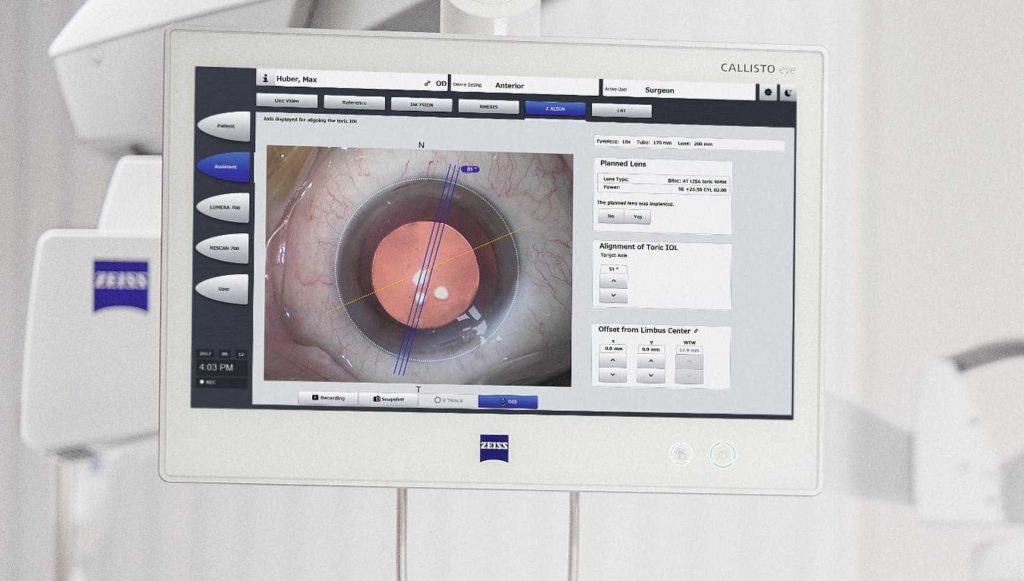 ZEISS IOLMaster 500 Optical Biometer - Ophthalmicmart